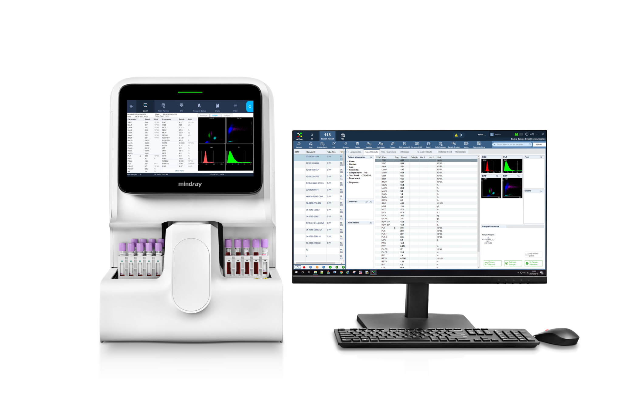 Mindray - Auto Haematology Analyser with ESR - Abacus dx