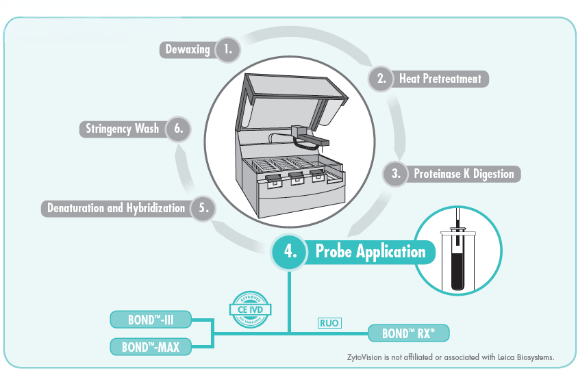 ZytoVision by Zytomics: Fully automated probes for the BOND™ Systems ...