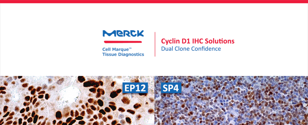 Cell Marque - Cyclin D1 IHC Solutions - Abacus dx