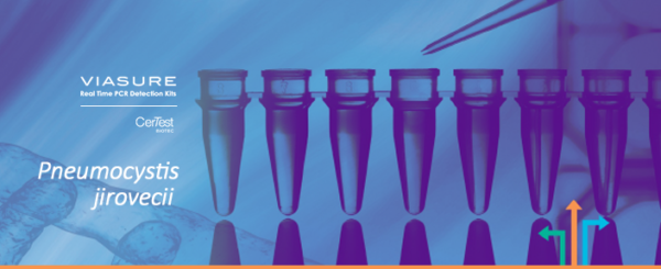 CerTest VIASURE Pneumocystis jirovecii RT PCR kit - Abacus dx