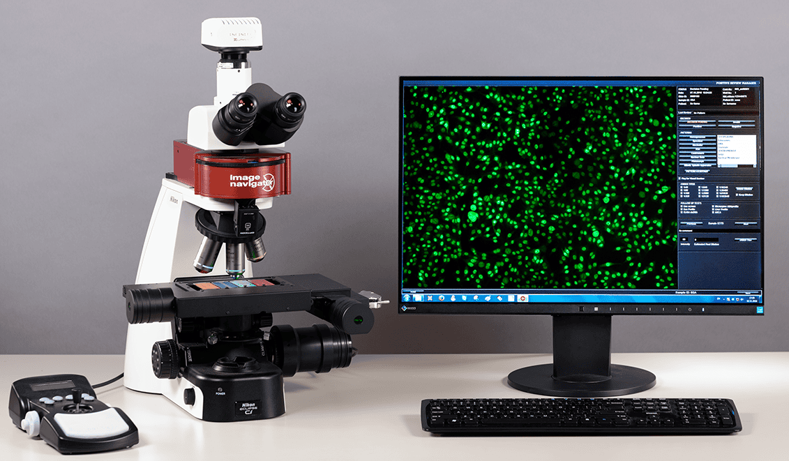 Immuno Concepts Image Navigator® for full IFA automation - Abacus dx