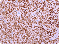 New Antibodies Available From Cell Marque